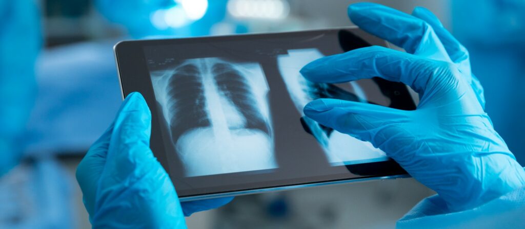 Computer Vision in Healthcare: Creating an AI Diagnostic Tool | AltexSoft Computer Vision in Healthcare: Creating an AI Diagnostic Tool | AltexSoft