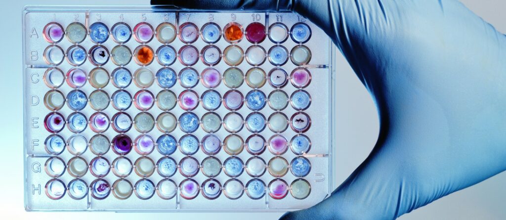 Data Analytics in Pharma: Use Cases and Examples | AltexSoft